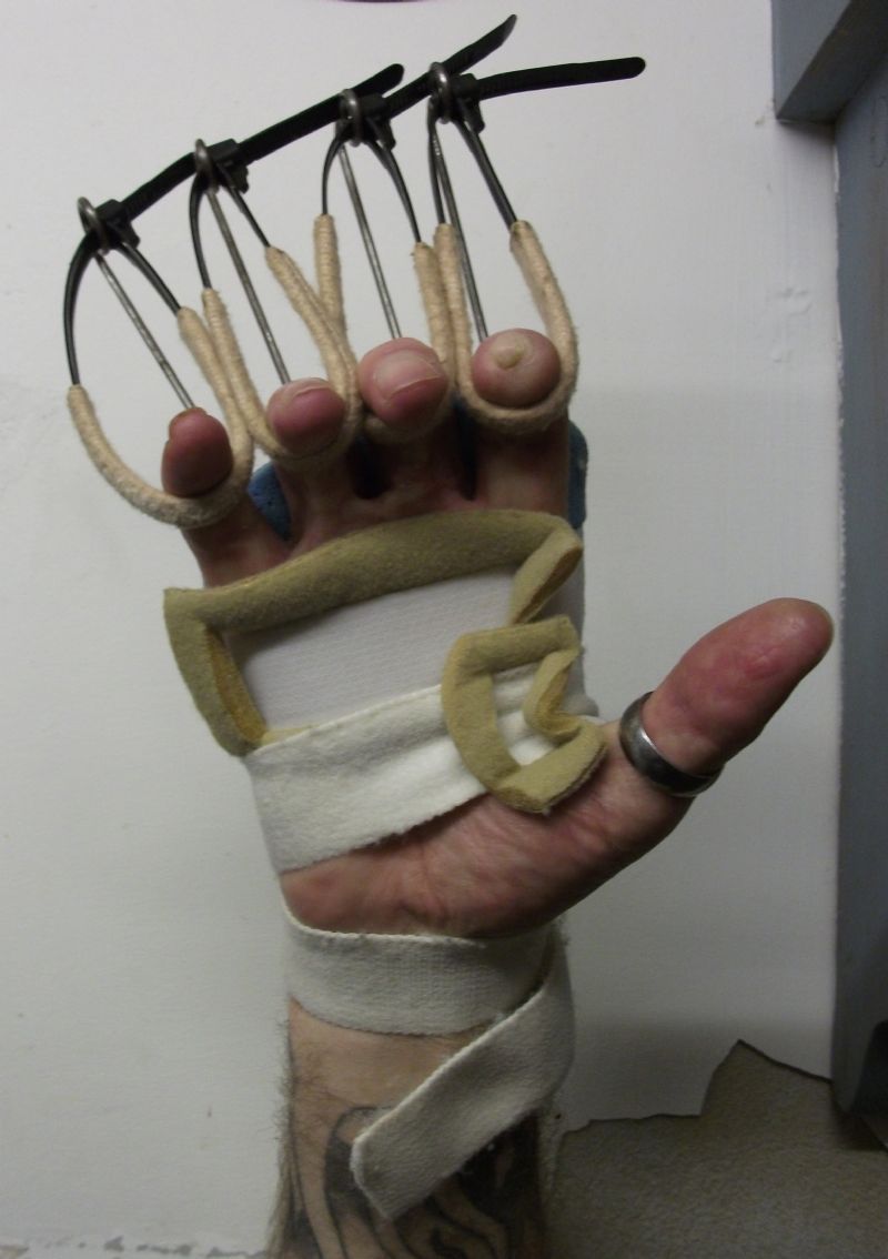 Finger splint 2 - hum's Photos - Banjo Hangout